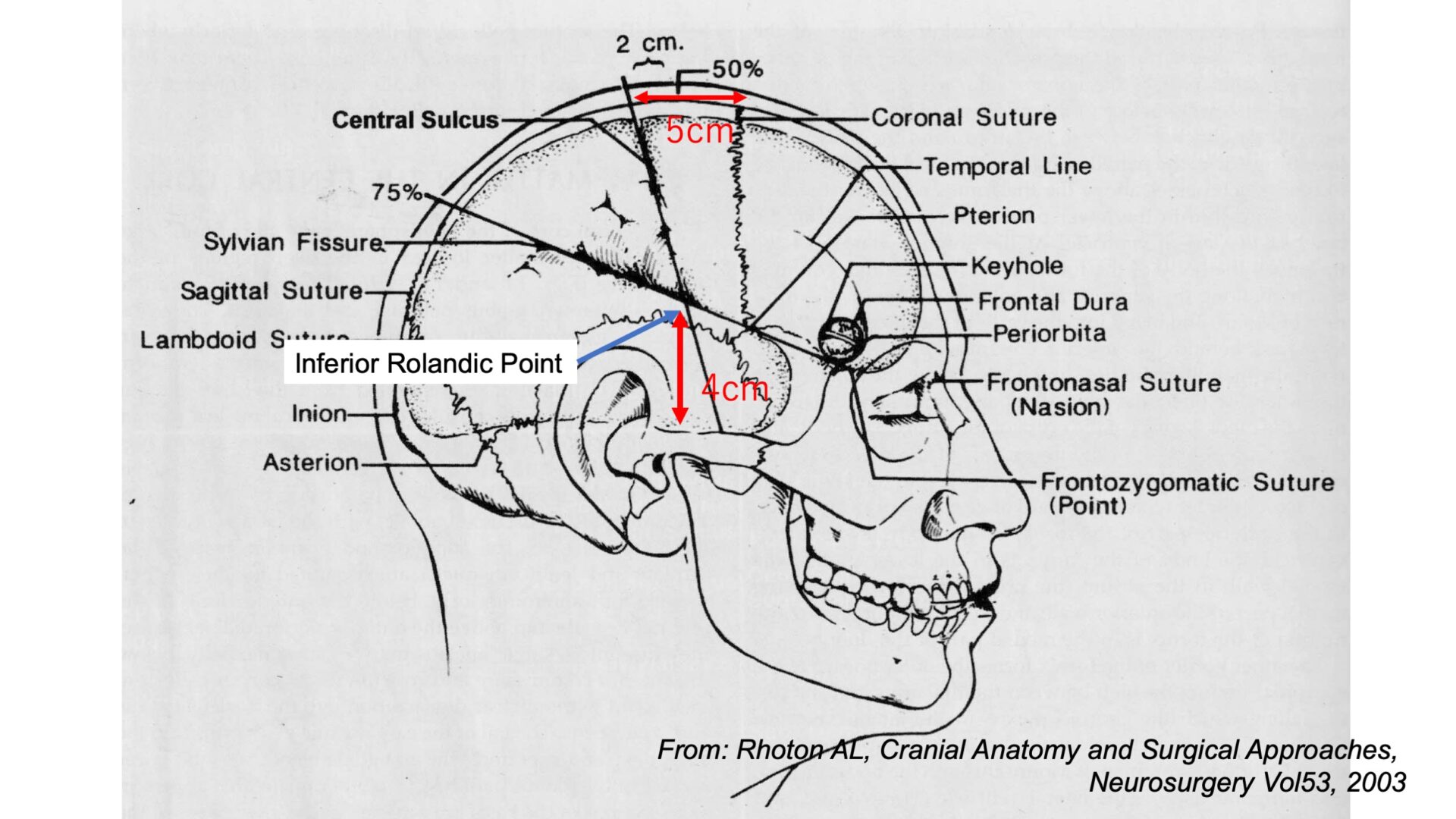 脳を透視する ｜ 日本医科大学 脳神経外科学教室