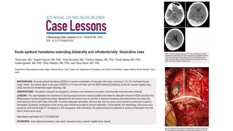 青木先生の論文がJNS case lessons に掲載 ｜ 日本医科大学 脳神経外科学教室